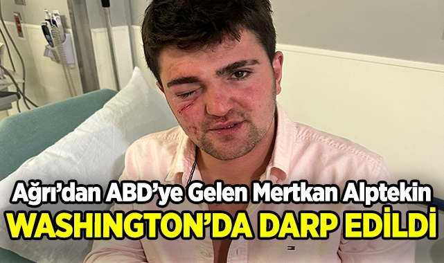 Ağrı'dan ABD'ye Gelen Mertkan Alptekin, Amerikalı biri Tarafından Darp Edildi! - www.abdpost.com ...