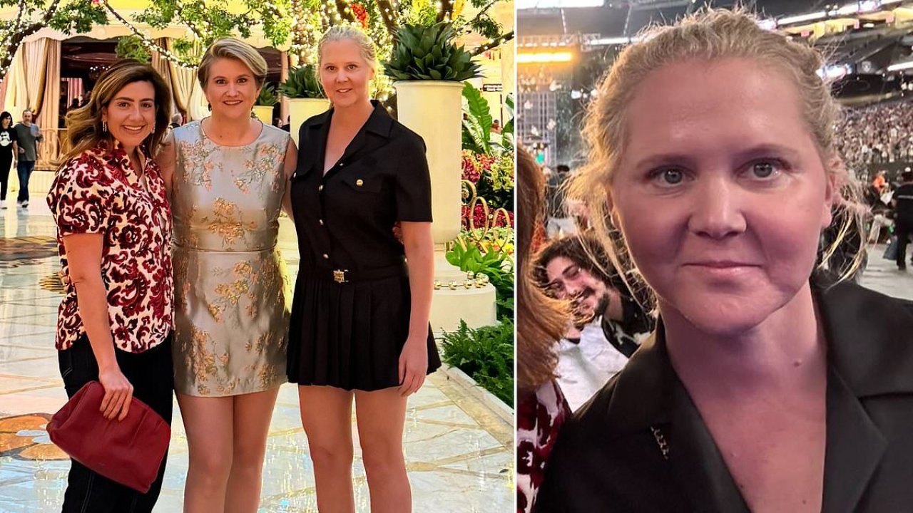 Amy Schumer shows off dramatic weight loss after Ozempic nightmare ...