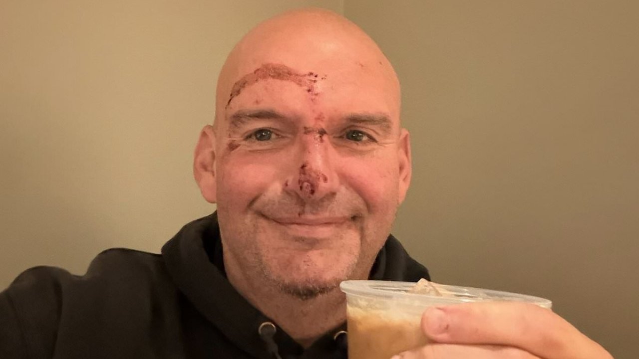 Fetterman posts selfie of scarred face after heart problem causes fall ...