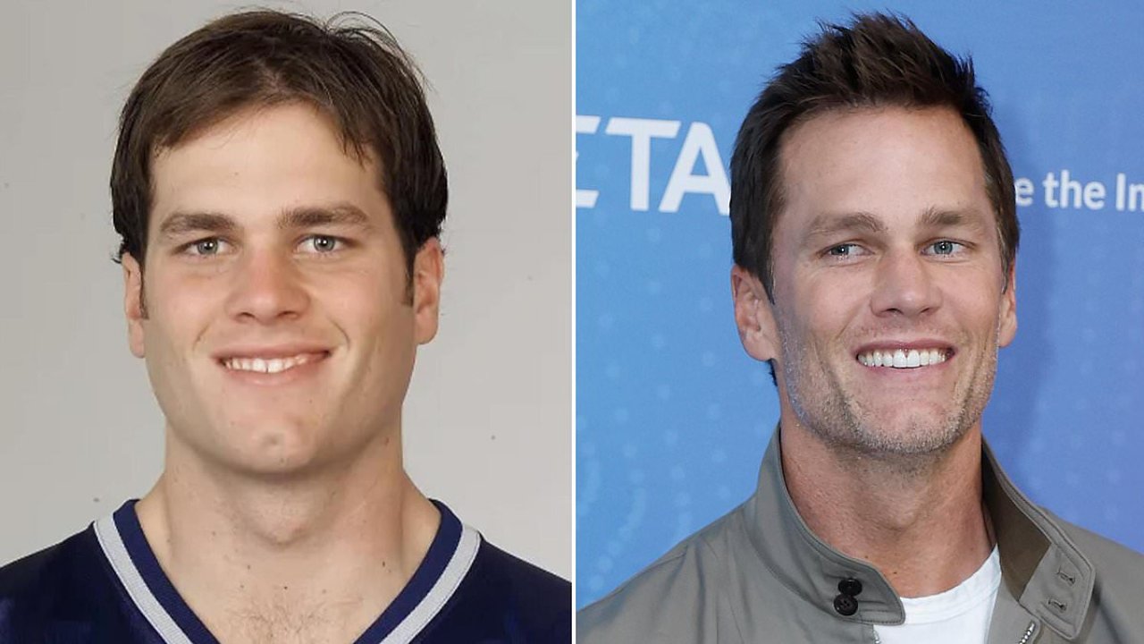 Plastic surgeon reveals secrets of Tom Brady's changing face - ABDPost ...