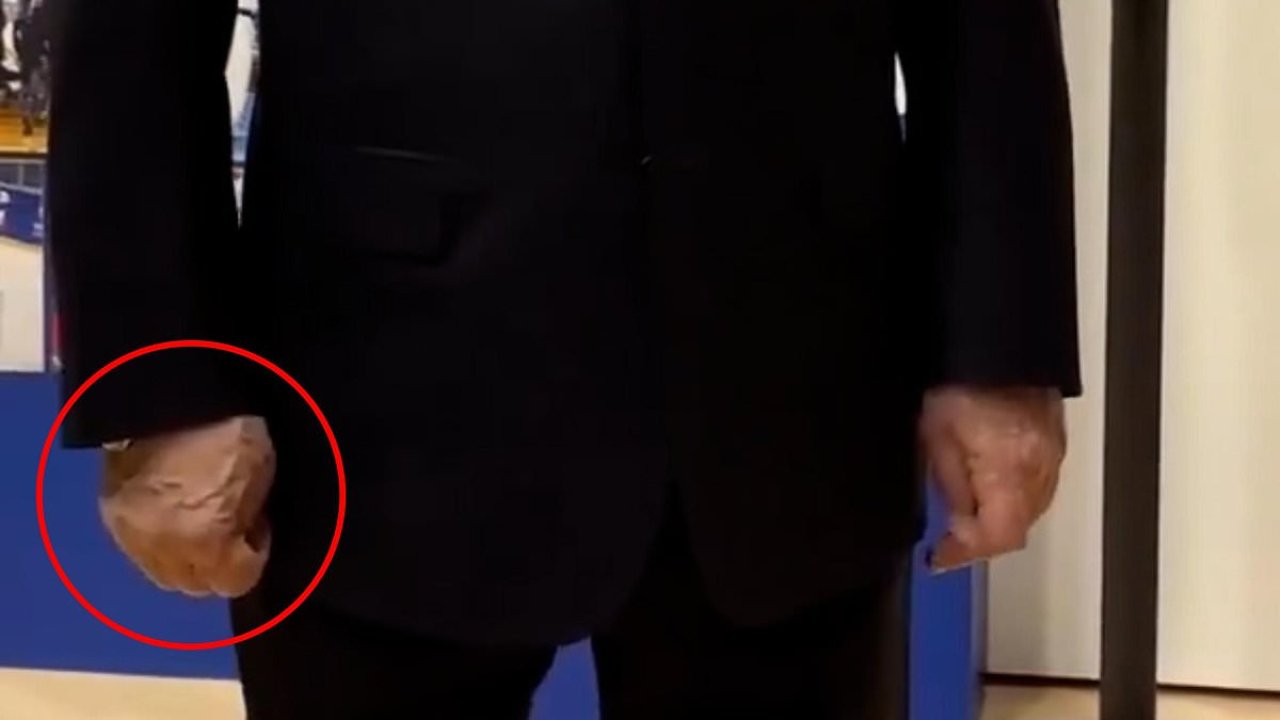 Putin's HANDSHAKE with health expert sparks new debate over wellbeing ...