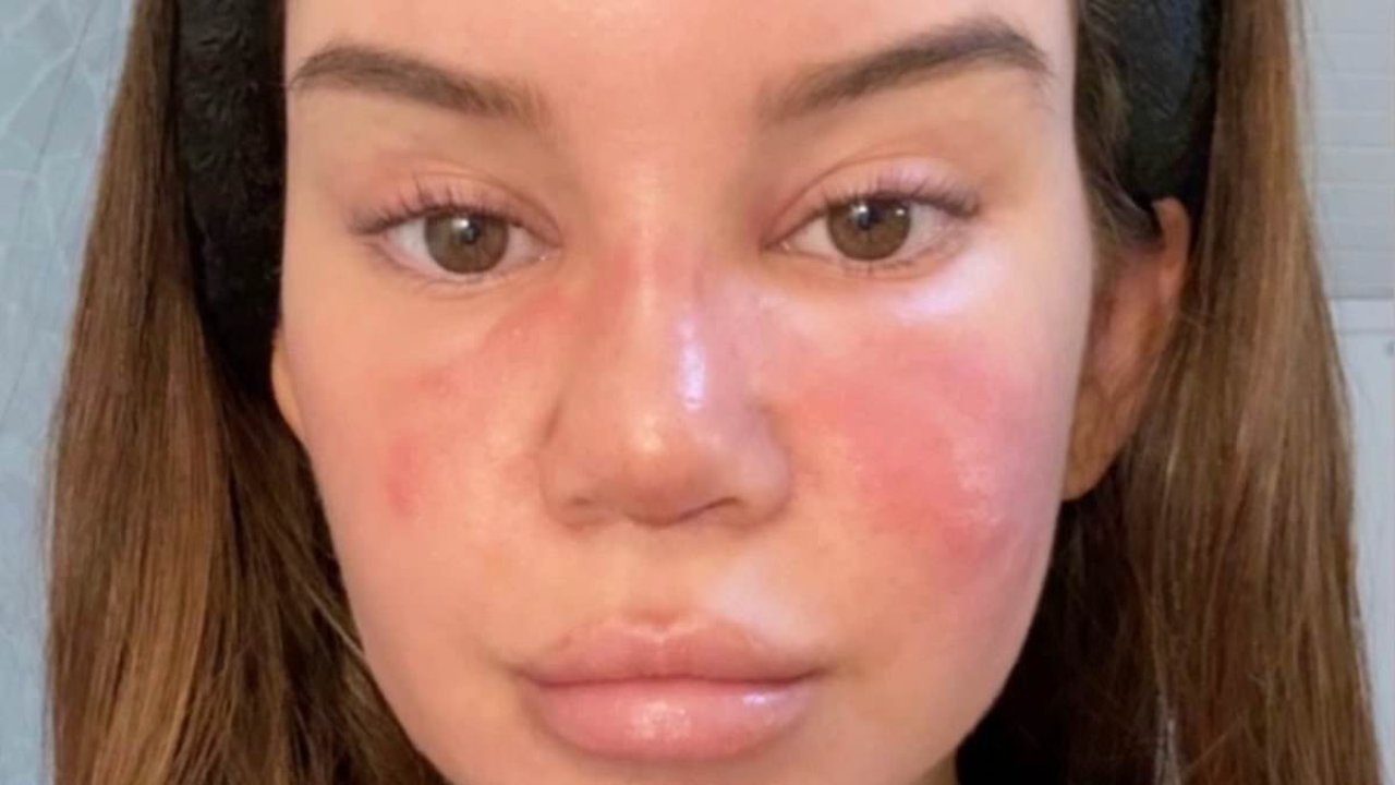 Country star suffered face-swelling 'sinus infection' before NYE show ...